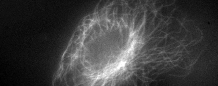 sCMOS Camera Equipped with SIM Super-Resolution Microscope for ...